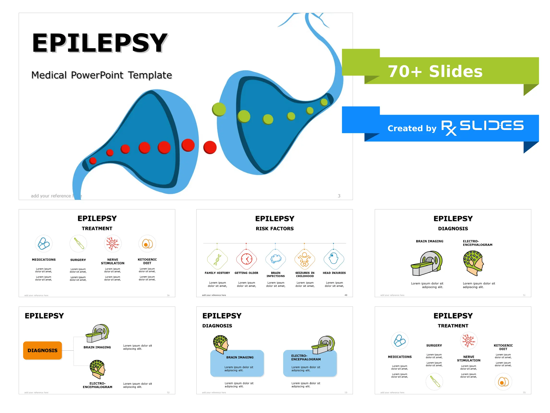 Download Epilepsy PowerPoint Template| RxSlides